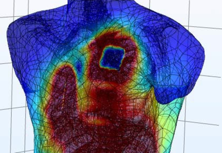 3D Image Processing Case Studies - Simpleware | Synopsys