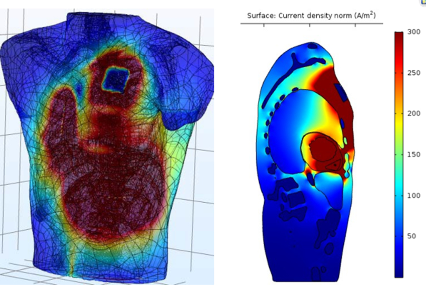 Torso Model Generation for Simulating Pacemaker Performance | Synopsys ...