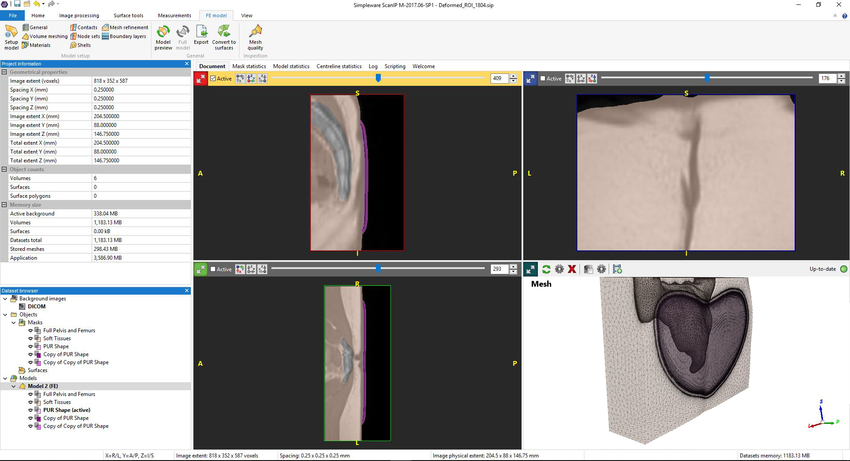 Modeling Prophylactic Sacral Dressings | Synopsys Simpleware
