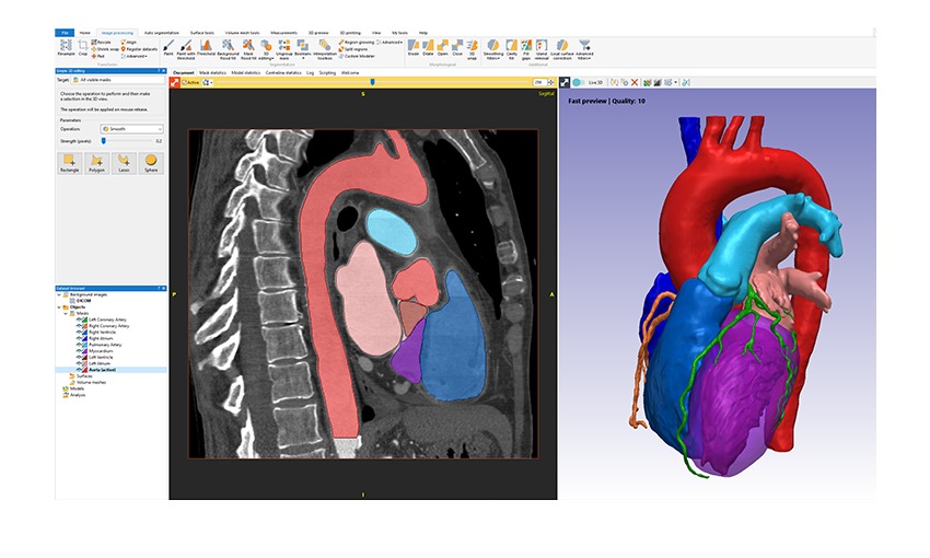 Simpleware for Point-of-Care (POC) 3D Printing | Synopsys