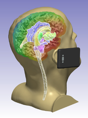 Image to 3D Models Software | Simpleware Solutions