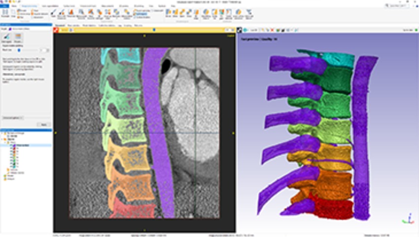 3D Image Processing News and Events - Simpleware | Synopsys