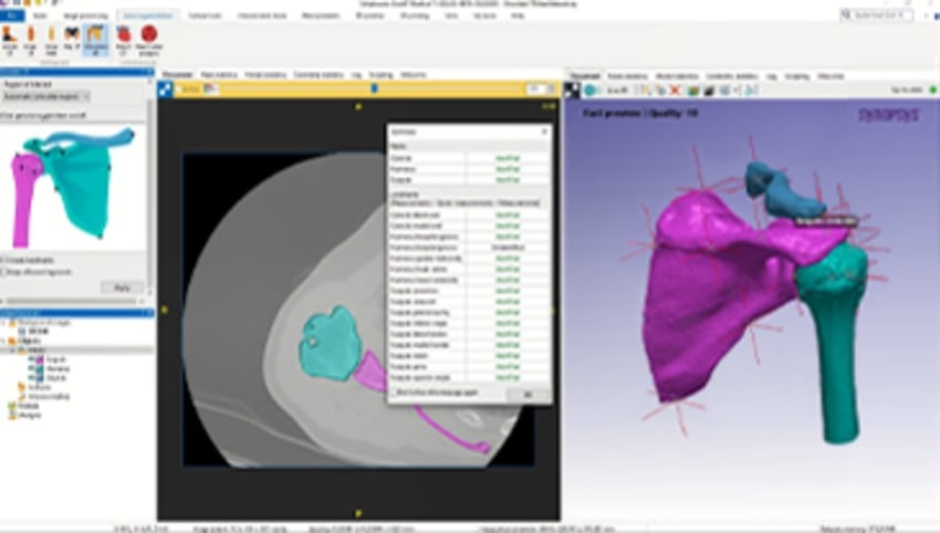 3D Image Processing News and Events - Simpleware | Synopsys