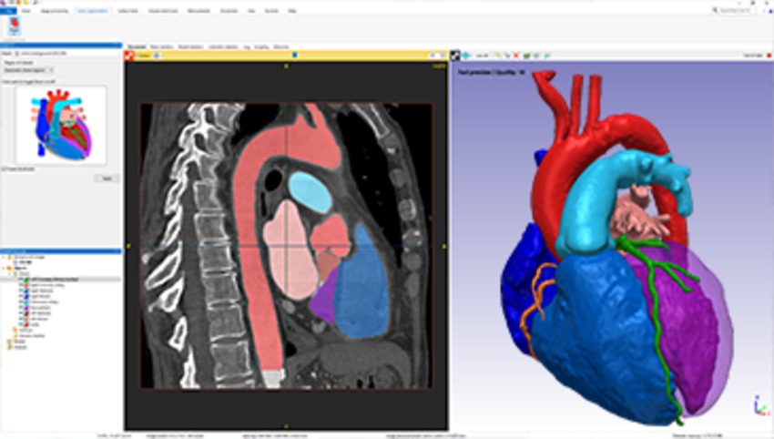 3D Image Processing News and Events - Simpleware | Synopsys