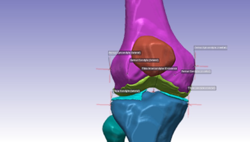 3D Image Processing News and Events - Simpleware | Synopsys