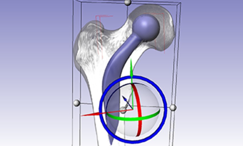 3D Image Processing Case Studies - Simpleware | Synopsys