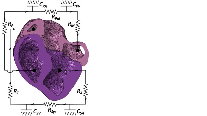 Using Digital Twins to Investigate Atrioventricular Block | Synopsys ...