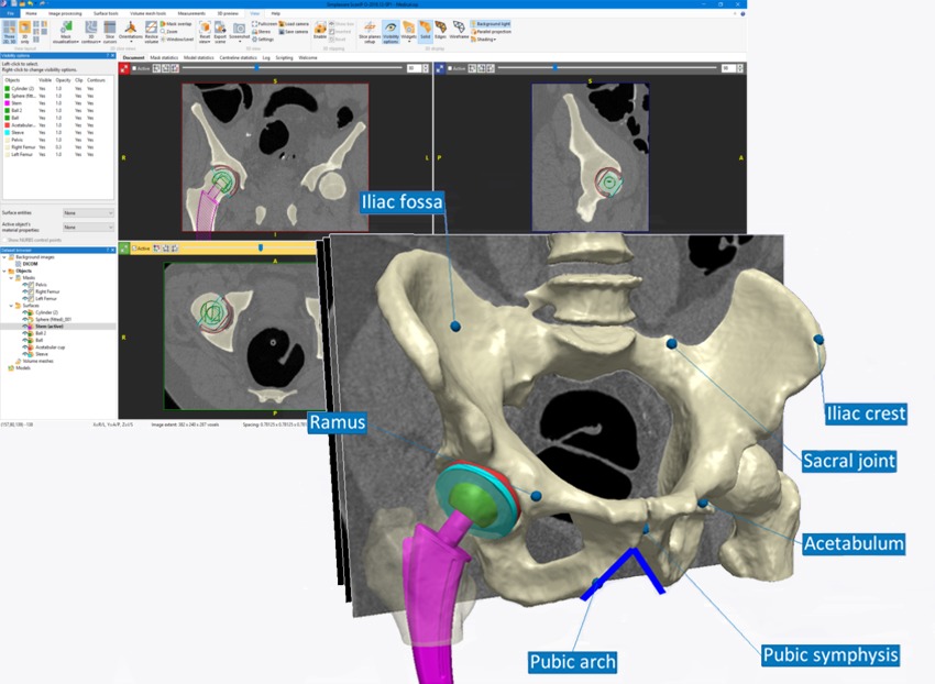 3D Medical Imaging Solutions - Simpleware ScanIP | Synopsys