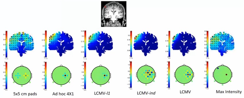 CCNY uses Simpleware 3D image processing software to create models for ...