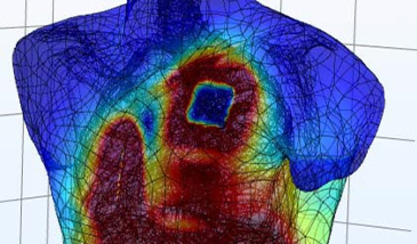 3D Image Processing Solutions - Simpleware | Synopsys