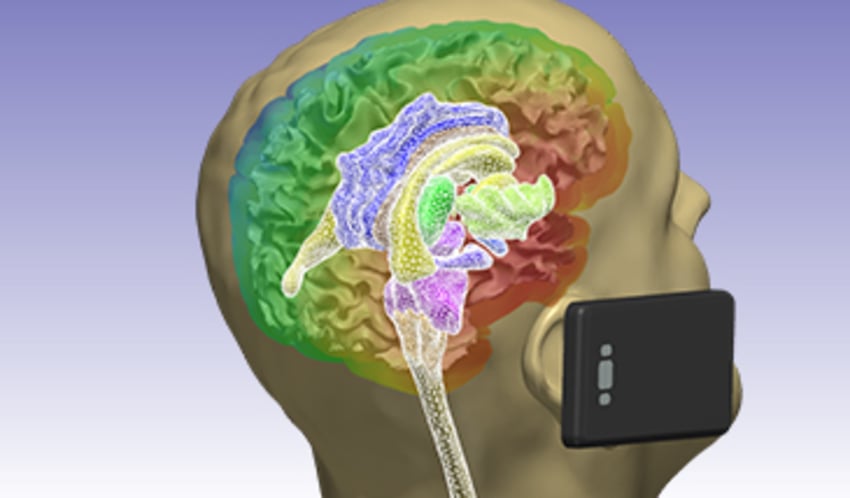 3D Image Processing Solutions - Simpleware | Synopsys