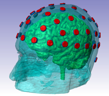 CCNY uses Simpleware 3D image processing software to create models for ...