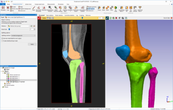 Image to 3D Models Software | Simpleware Solutions