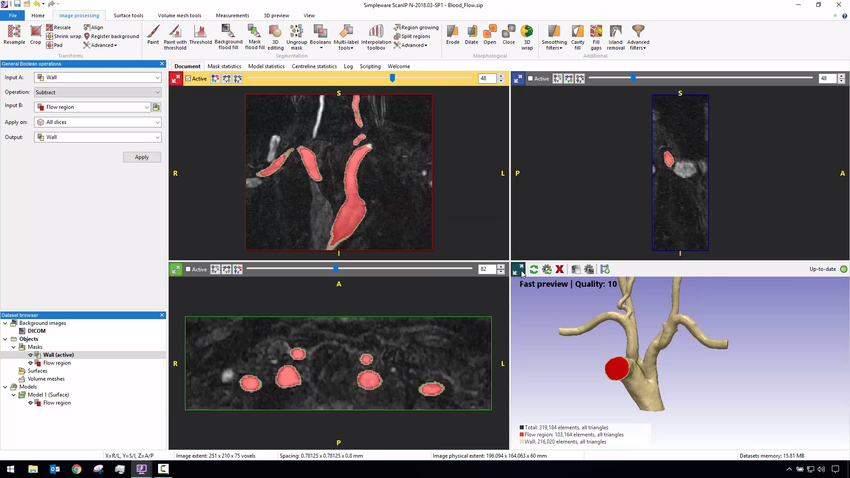 5 Top Tips to Speed Up Segmentation of Cardiovascular and Orthopedics ...