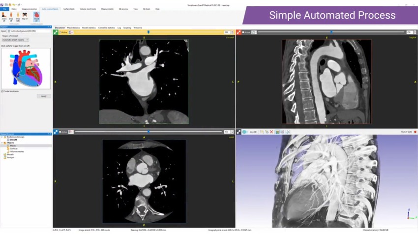 Simpleware for Point-of-Care (POC) 3D Printing | Synopsys