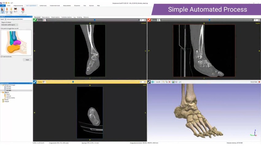 Simpleware for Point-of-Care (POC) 3D Printing | Synopsys